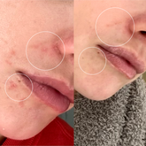 Beyond Miracles CELLSTORY Miracletox Liquid Microneedling Skincare